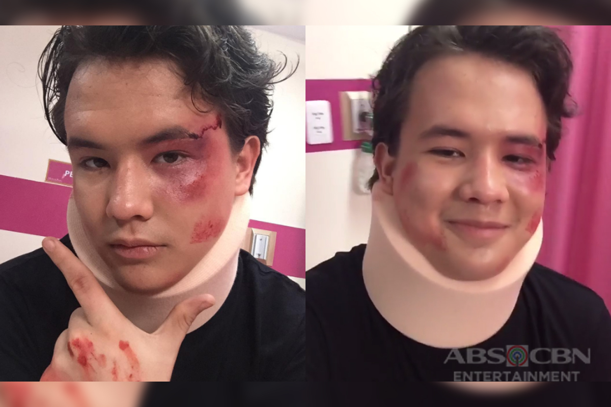 The real story behind Lucas’ accident in ALTL | ABS-CBN Entertainment