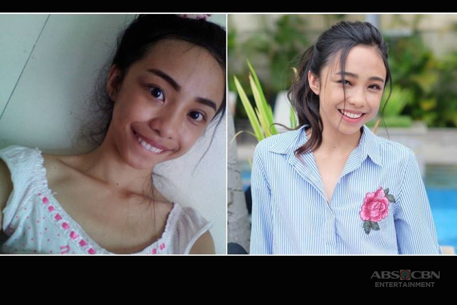 PHOTOS: Maymay Entrata's beautiful transformation in 20 photos | ABS ...